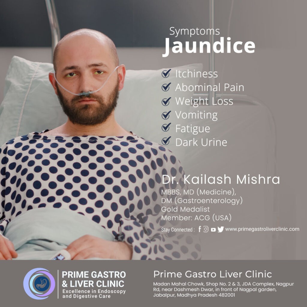 What Is Jaundice Types Causes Symptoms Prevention Prime Gastro Liver Clinic