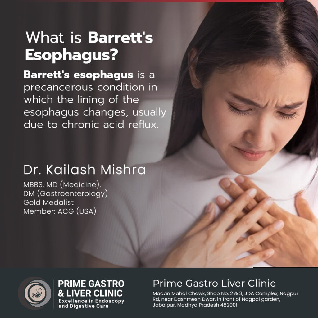What Is Barretts Esophagus Diagnosed Risk Management And More